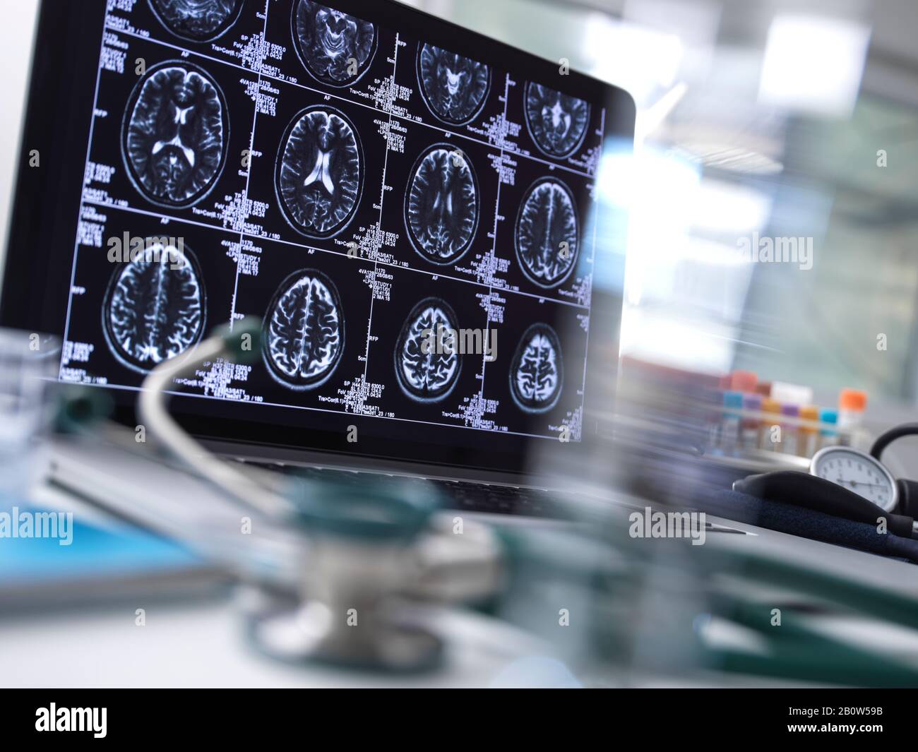 Close up of stethoscope and brain scan on a computer screen Stock Photo ...