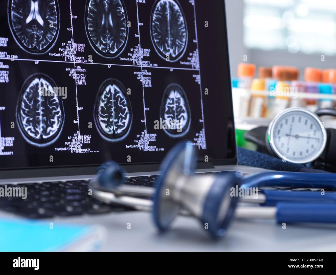 Close up of stethoscope and brain scan on a computer screen Stock Photo ...