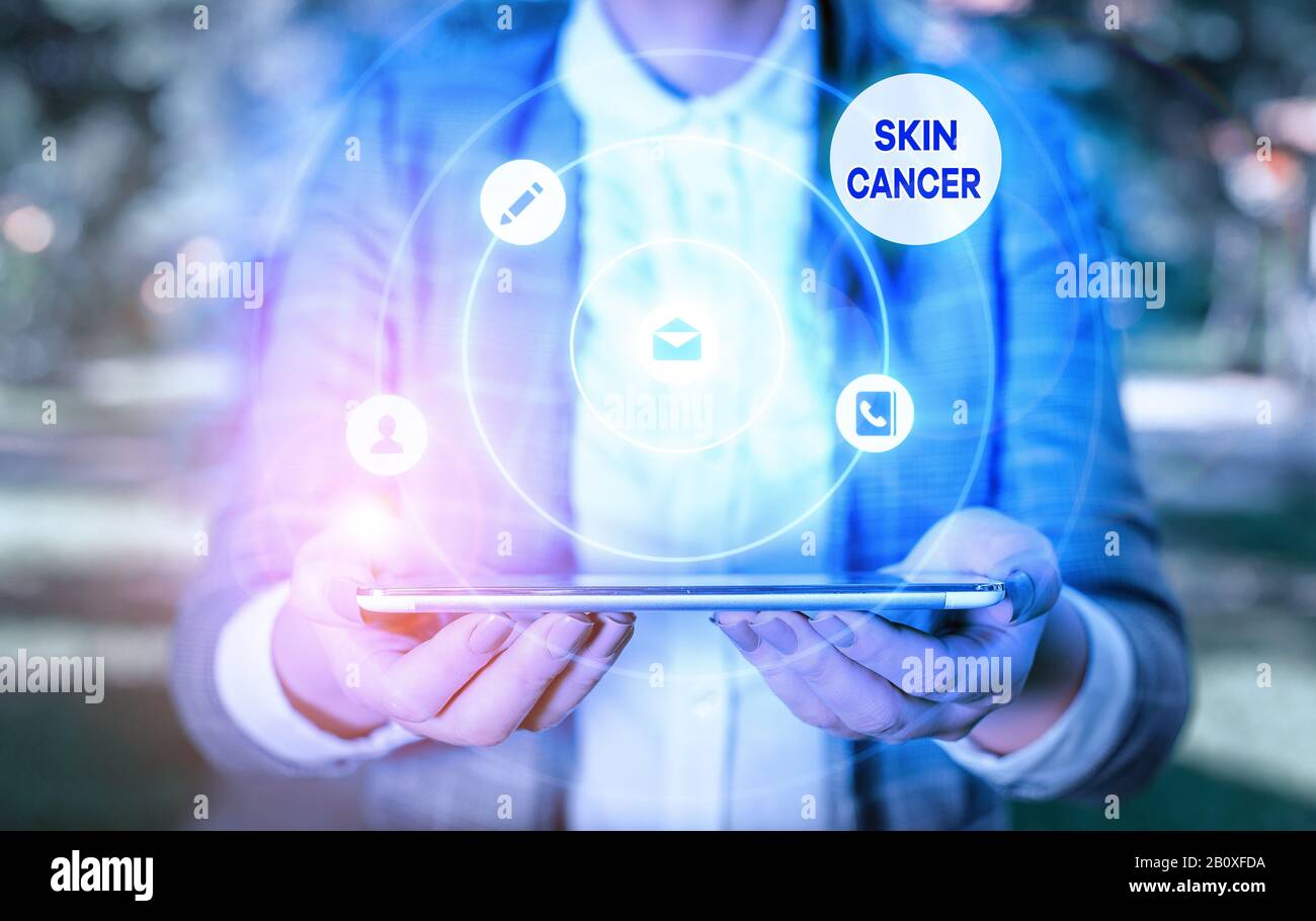 Writing note showing Skin Cancer. Business concept for uncontrolled ...