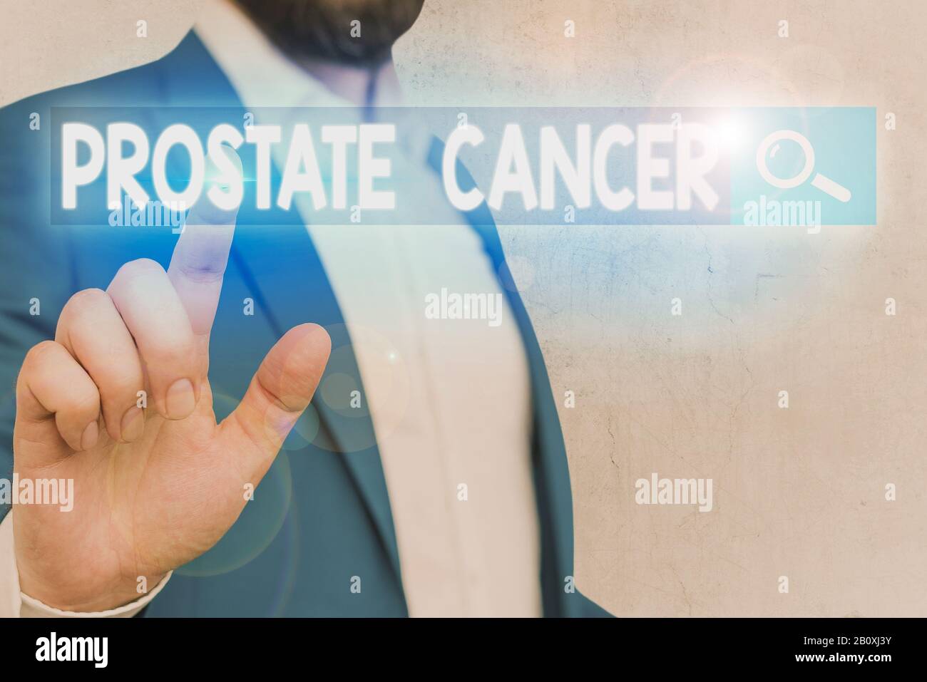 Word writing text Prostate Cancer. Business photo showcasing cancer ...
