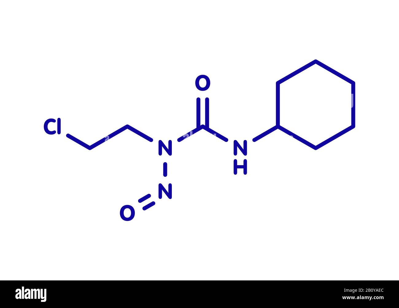 Brain tumour chemotherapy hi-res stock photography and images - Alamy
