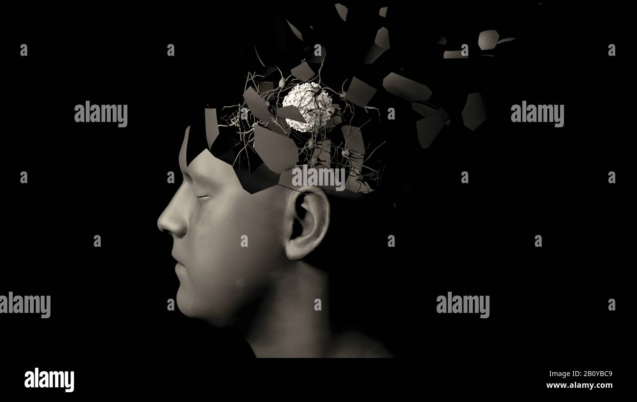 Brain cancer, conceptual illustration Stock Photo - Alamy Brain cancer, conceptual illustration Stock Photo - Alamy