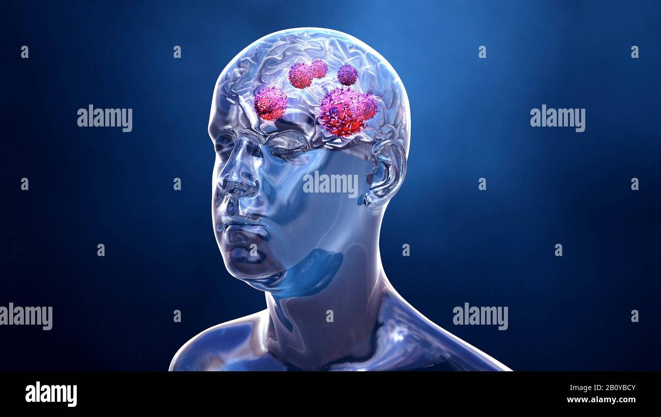 Human brain cancer cell hi-res stock photography and images - Alamy