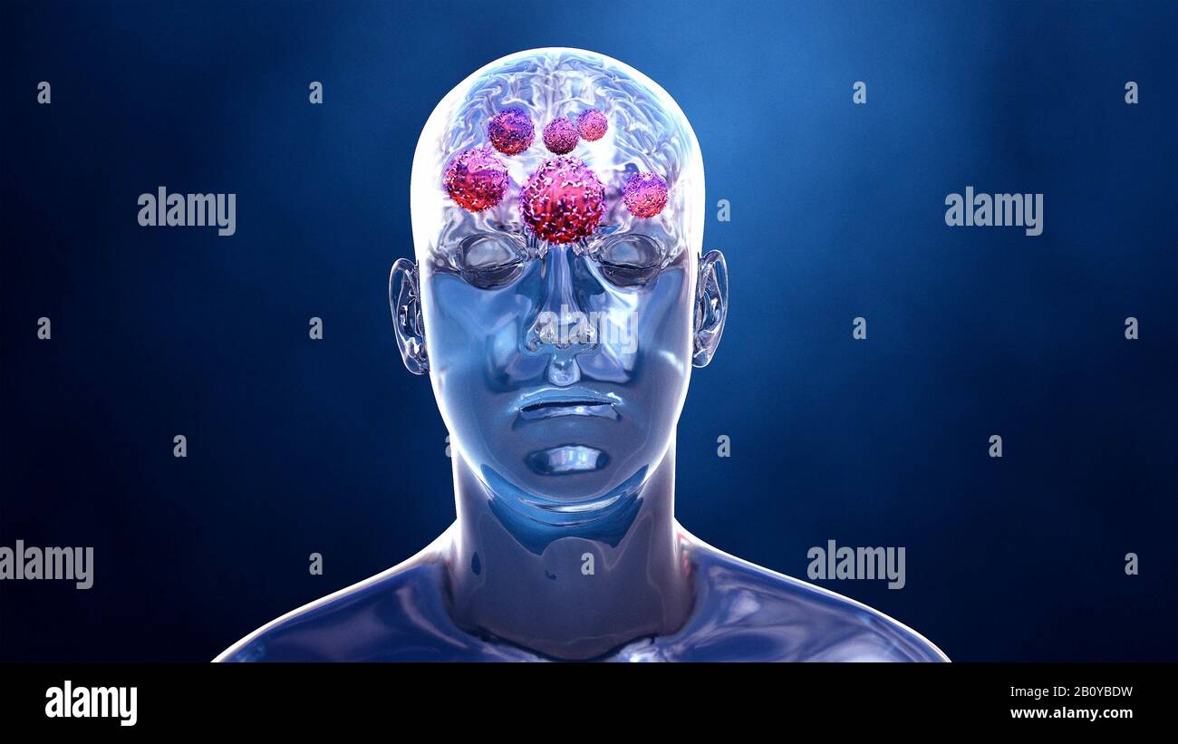 Brain cancer, conceptual illustration Stock Photo - Alamy