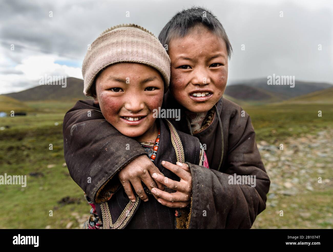 Early traces of rough skin on the face of nomadic Tibetan children ...