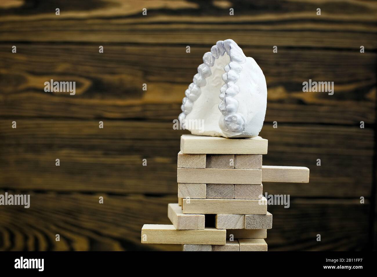 Right side view of a clear aligner or retainer for the lower teeth, a ...