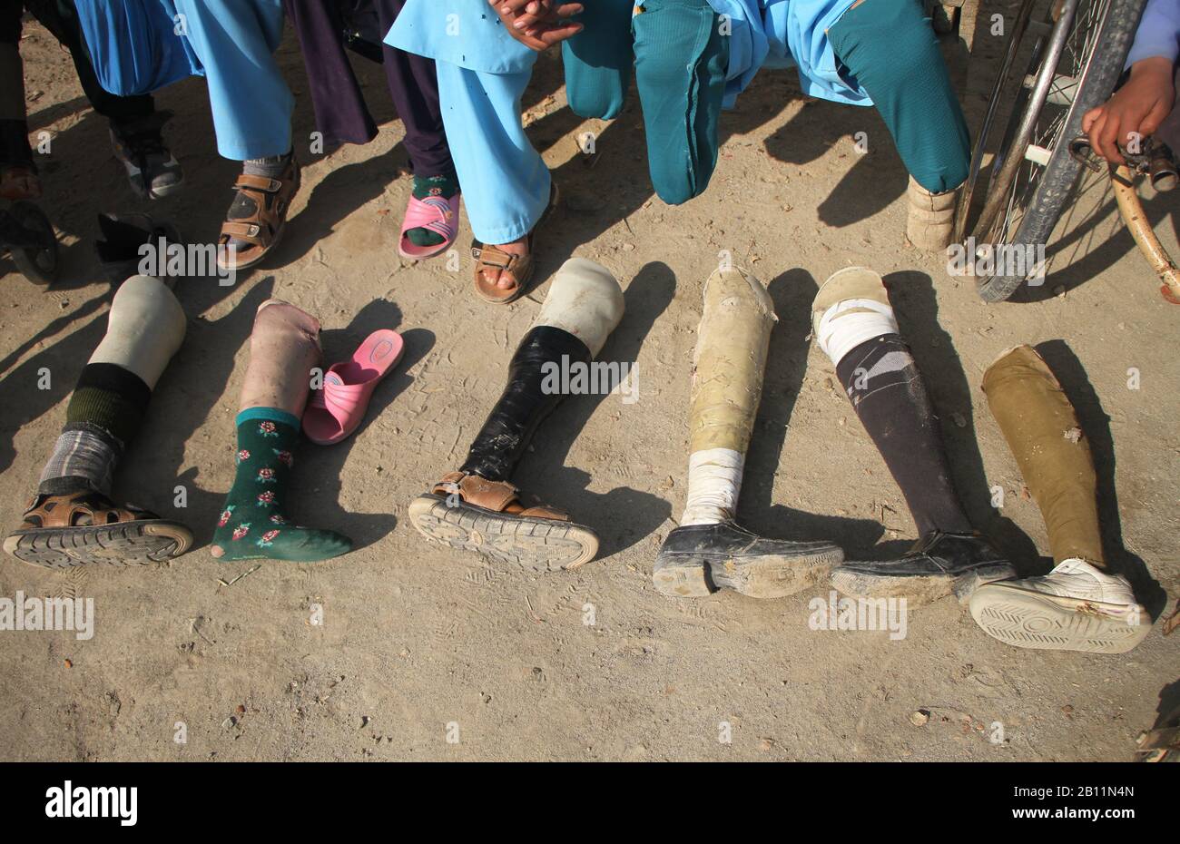 Prosthetic legs, children hi-res stock photography and images - Alamy