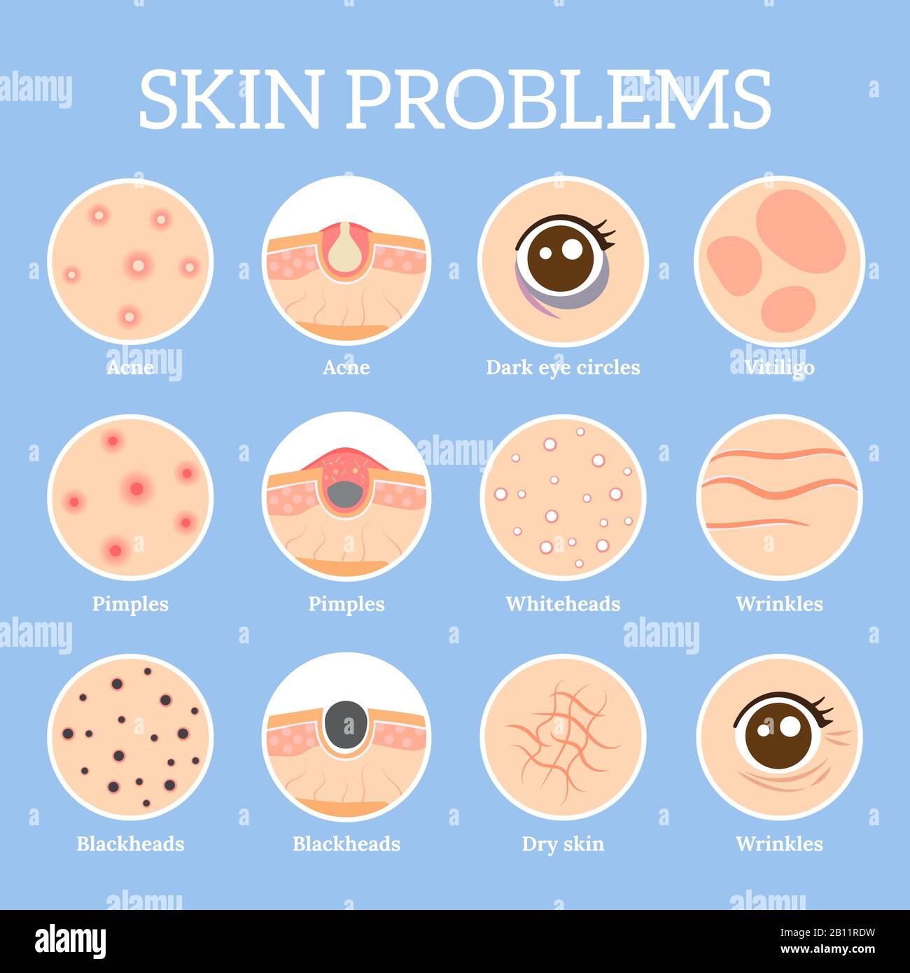 Skin problems. Ages wrinkles problem, face skin infection treatment and ...