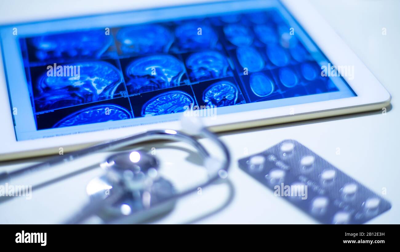 Closed up on Stethoscope and Tablet displaying brain activity scan ...