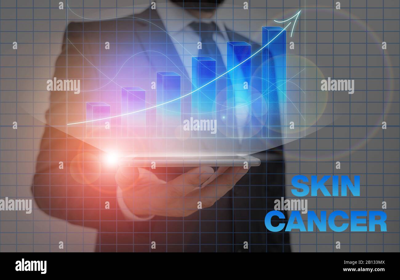 Writing note showing Skin Cancer. Business concept for uncontrolled ...