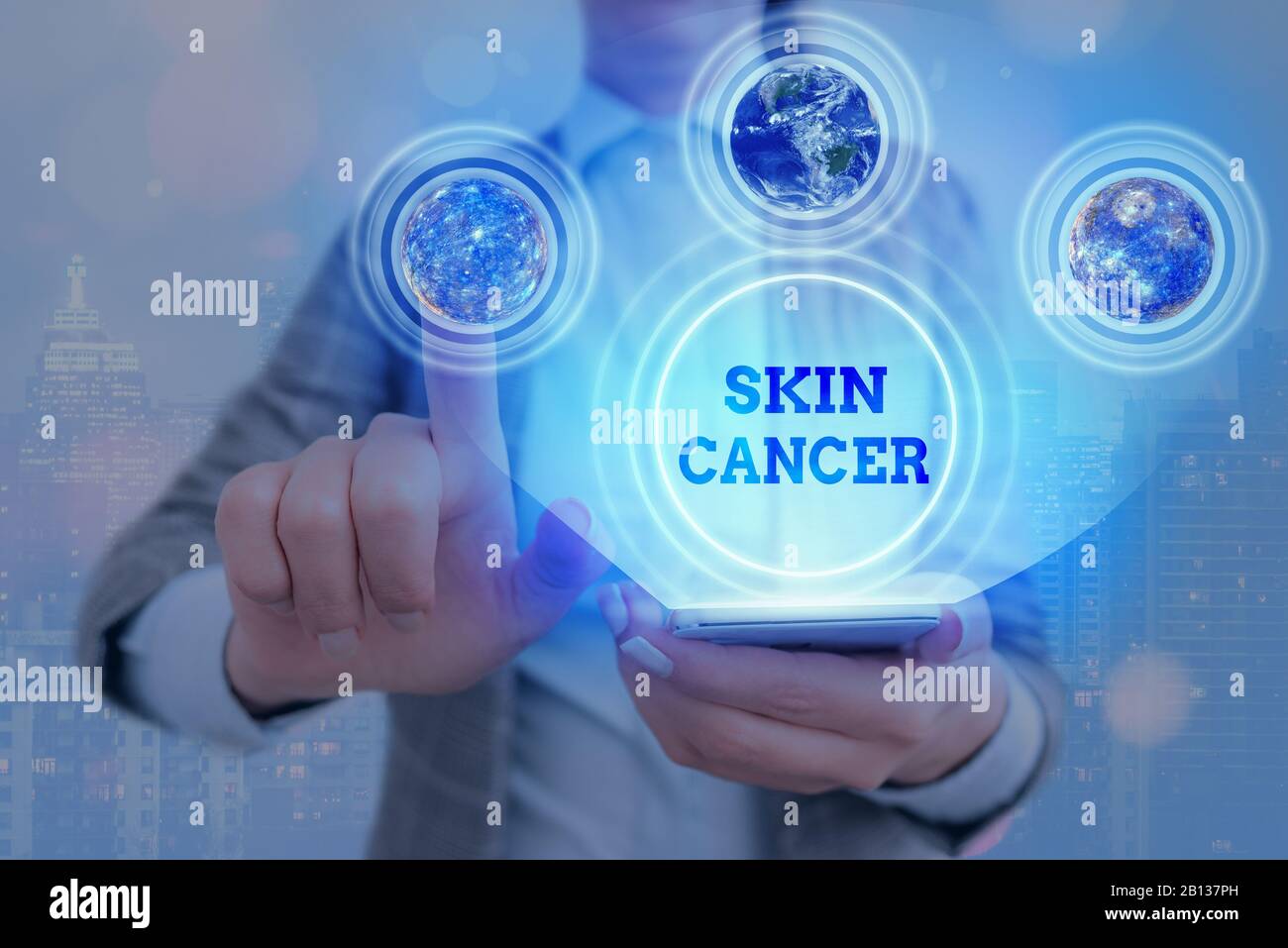 Handwriting text writing Skin Cancer. Conceptual photo uncontrolled ...