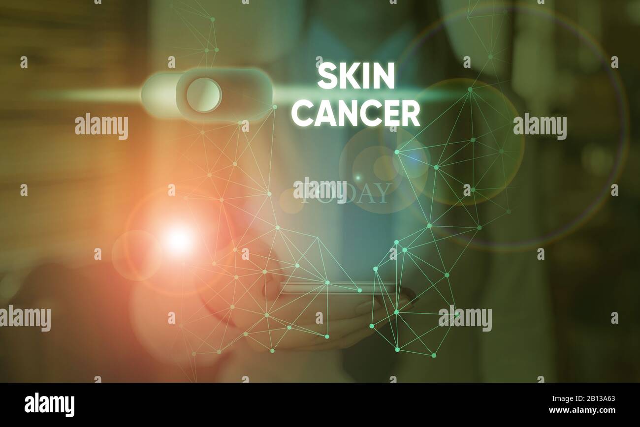 Handwriting text Skin Cancer. Conceptual photo uncontrolled growth of ...