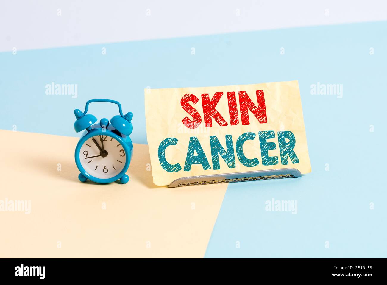 Writing note showing Skin Cancer. Business concept for uncontrolled ...