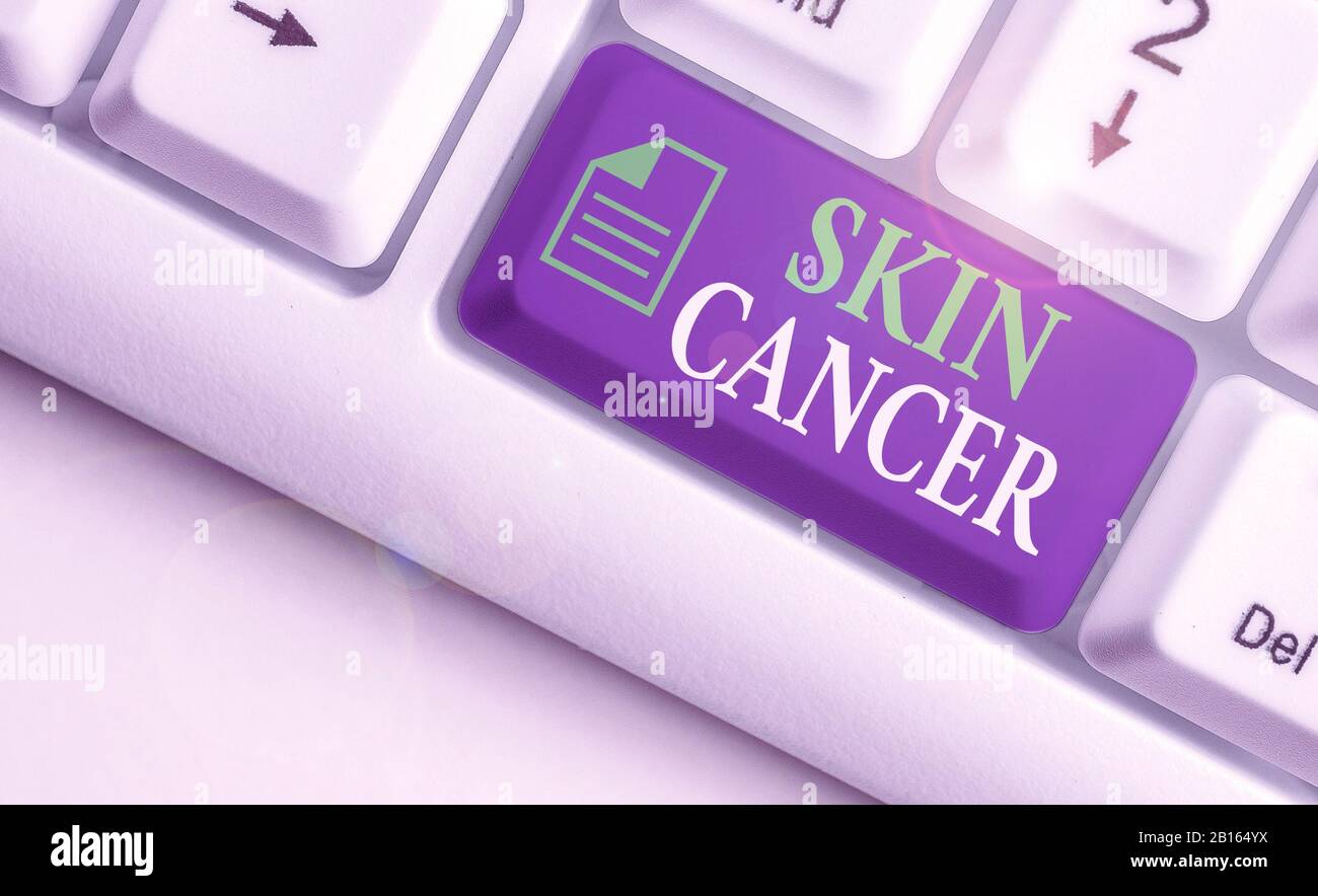 Writing note showing Skin Cancer. Business concept for uncontrolled ...
