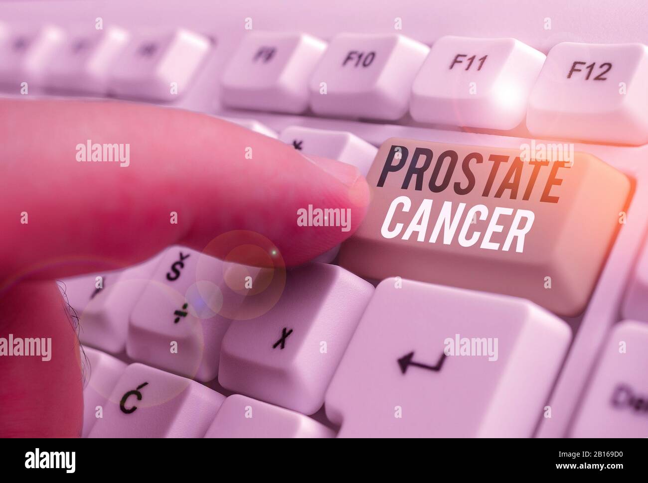 Conceptual hand writing showing Prostate Cancer. Concept meaning cancer ...