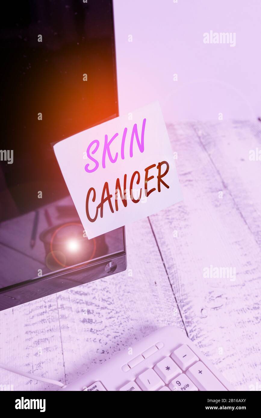 Handwriting text writing Skin Cancer. Conceptual photo uncontrolled ...