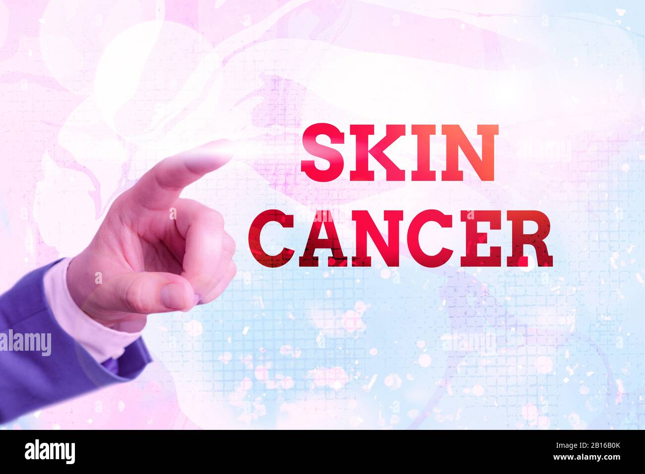 Writing note showing Skin Cancer. Business concept for uncontrolled ...
