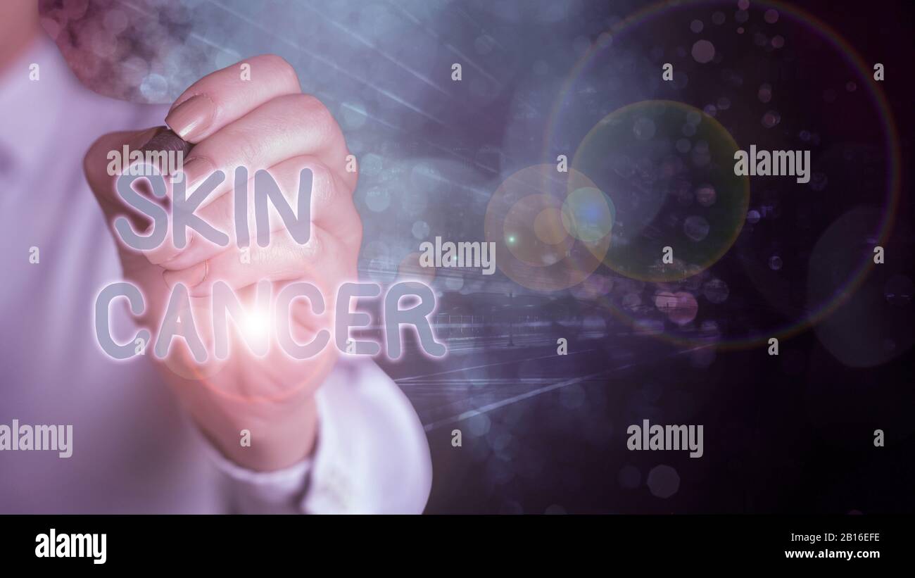 Writing note showing Skin Cancer. Business concept for uncontrolled ...