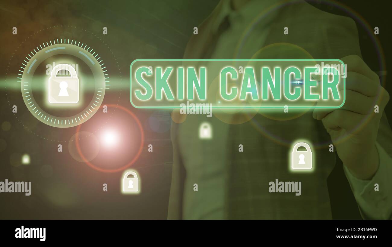 Word writing text Skin Cancer. Business photo showcasing uncontrolled ...