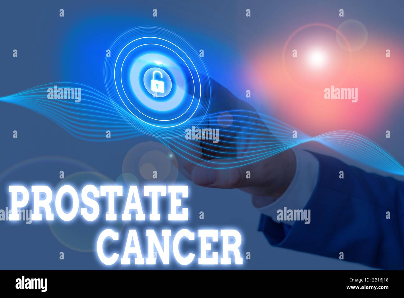Writing note showing Prostate Cancer. Business concept for cancer ...
