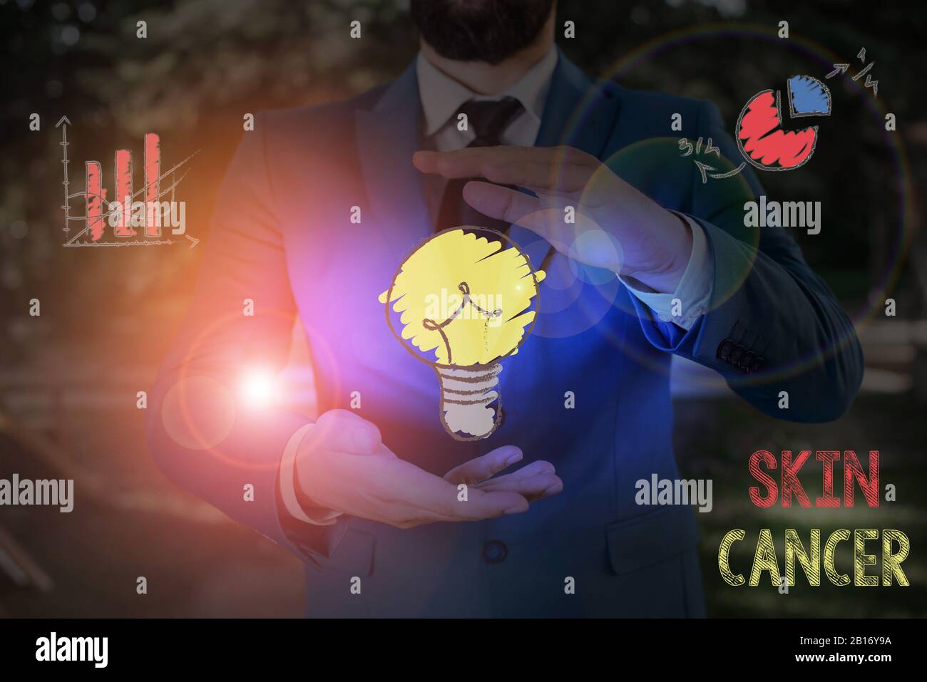 Handwriting text Skin Cancer. Conceptual photo uncontrolled growth of ...