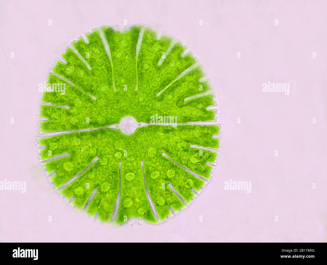 Micrasterias thomasiana hi-res stock photography and images - Alamy