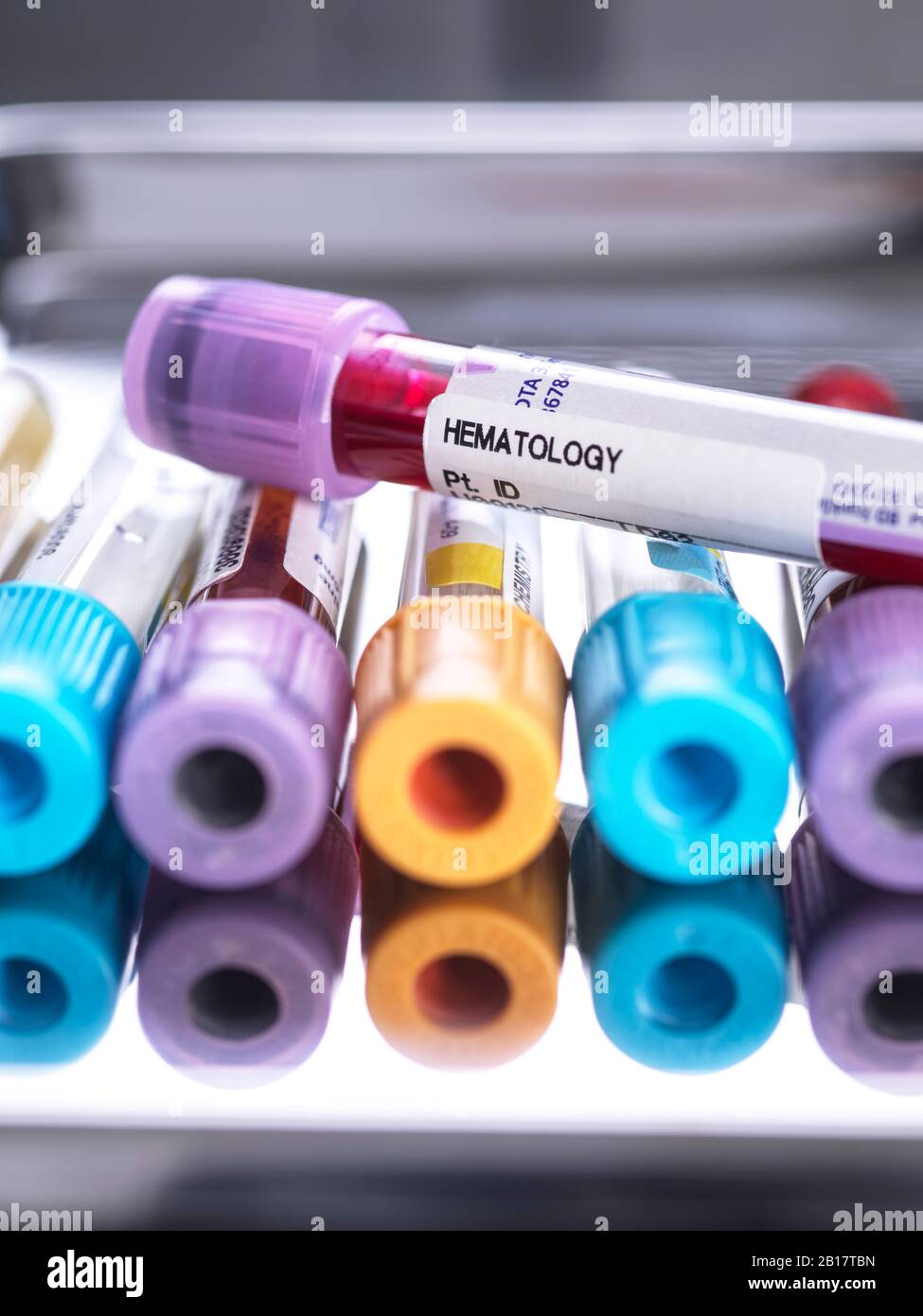 Blood screening in lab hi-res stock photography and images - Alamy