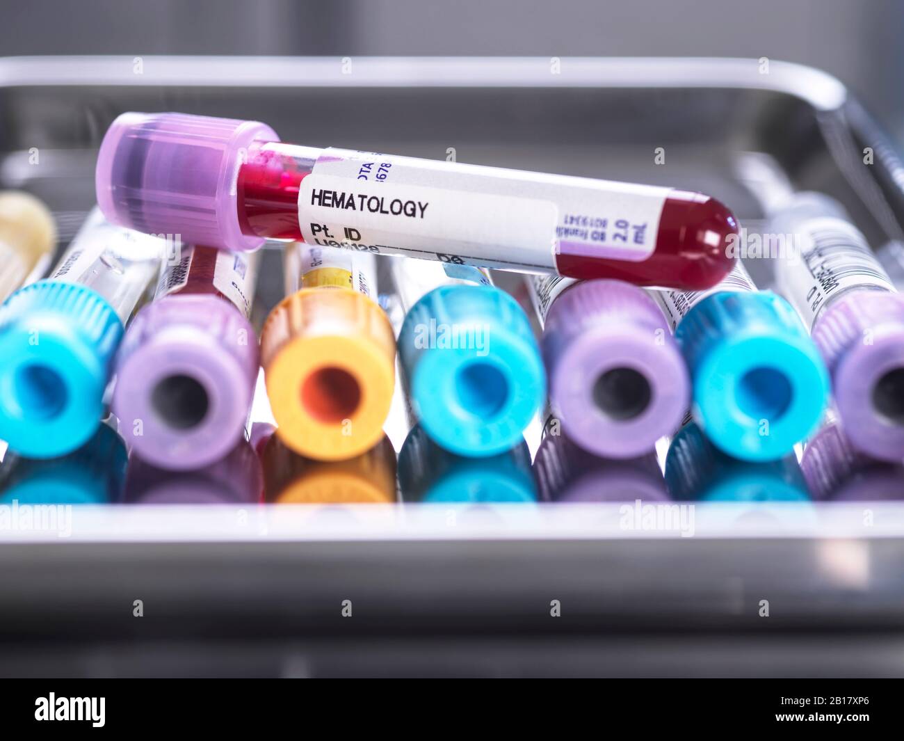 Human blood samples awaiting screening in lab Stock Photo - Alamy