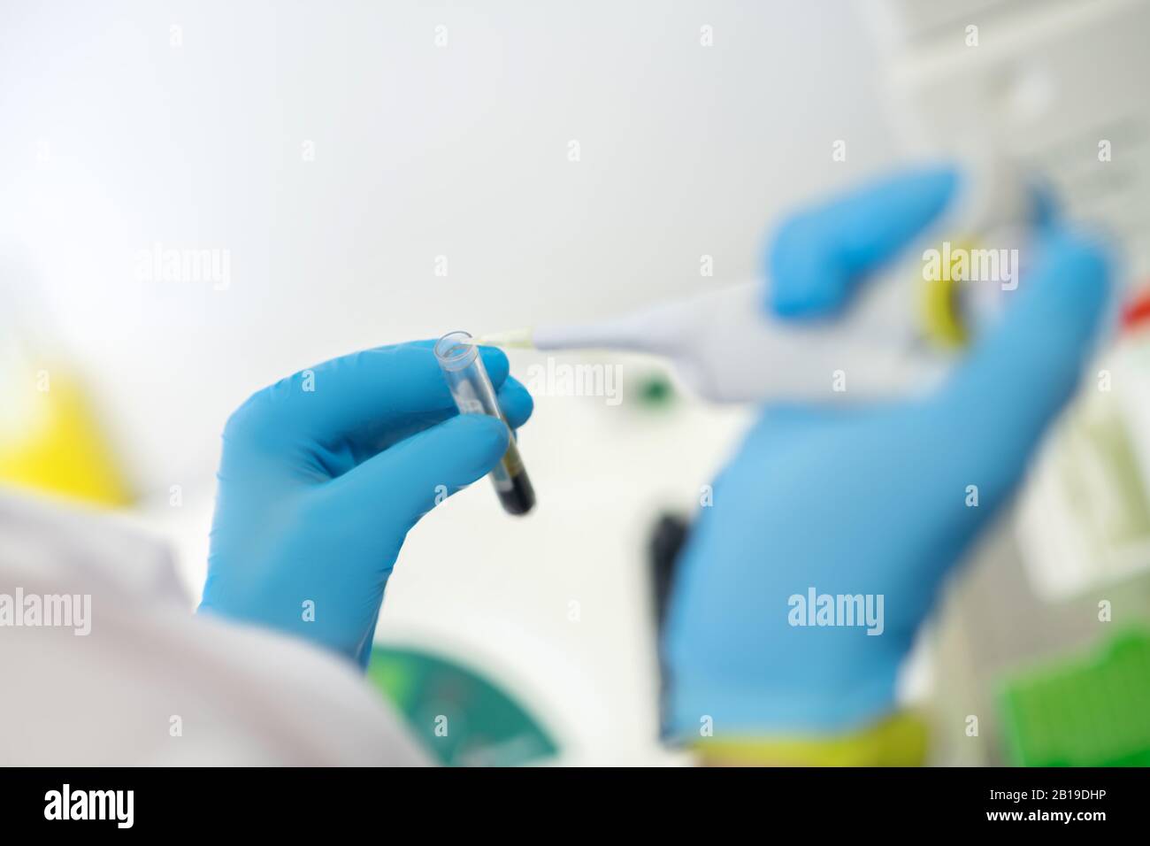 Close up picture of human hand with pipette and test tube Stock Photo ...