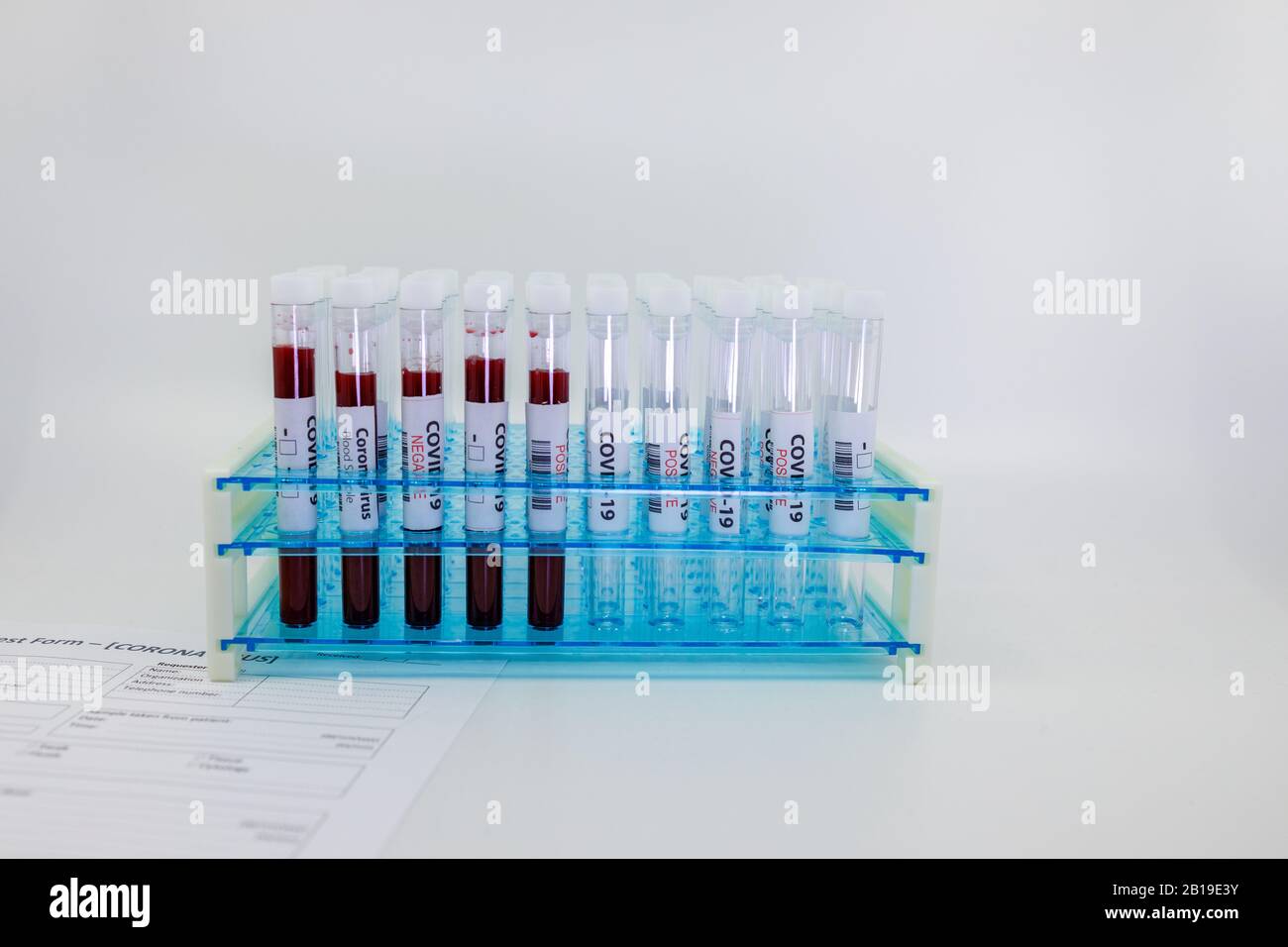 Test tubes rack with blood sample for coronavirus, covid-19 virus and ...