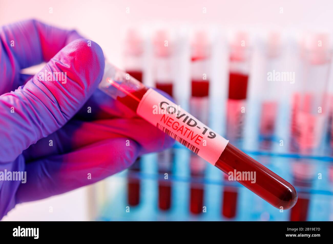 Close up of microbiologist hand with surgical gloves holding a negative ...