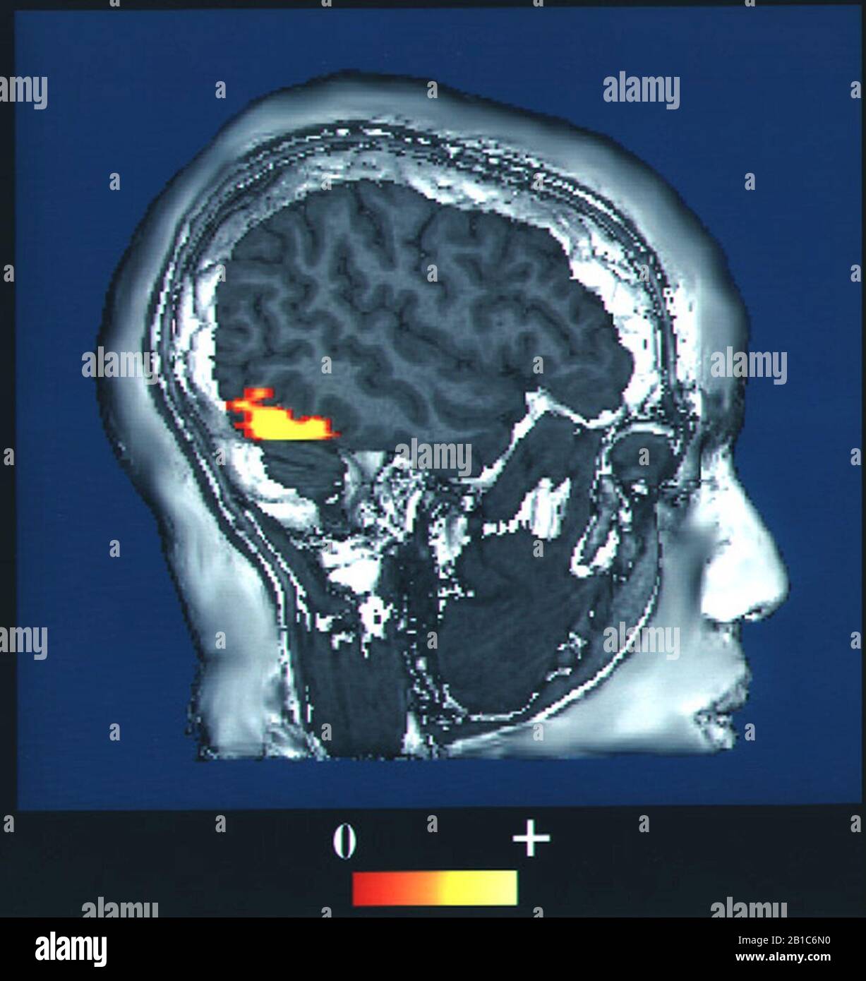 Fusiform hi-res stock photography and images - Alamy