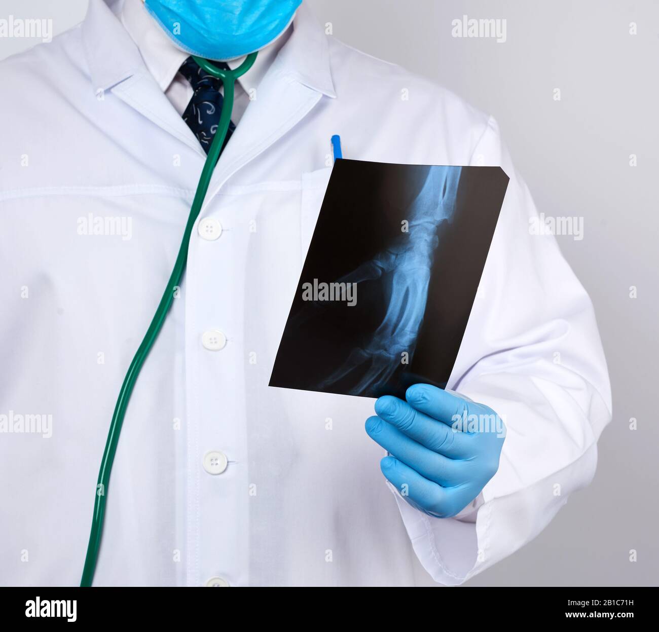 doctor in a white coat and blue latex gloves holds an x-ray of a man’s ...