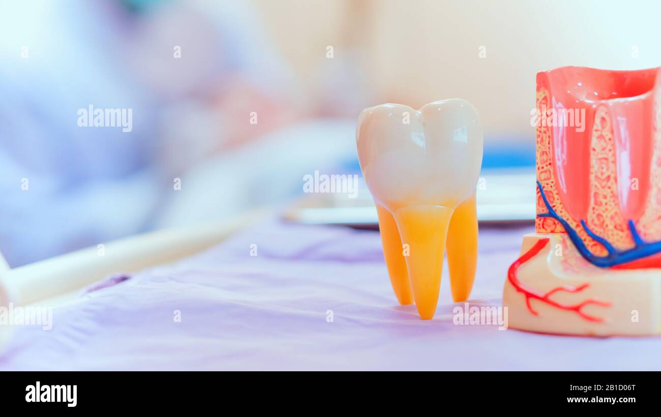 tooth implant false teeth. Dentistry and healthcare concept at dental ...