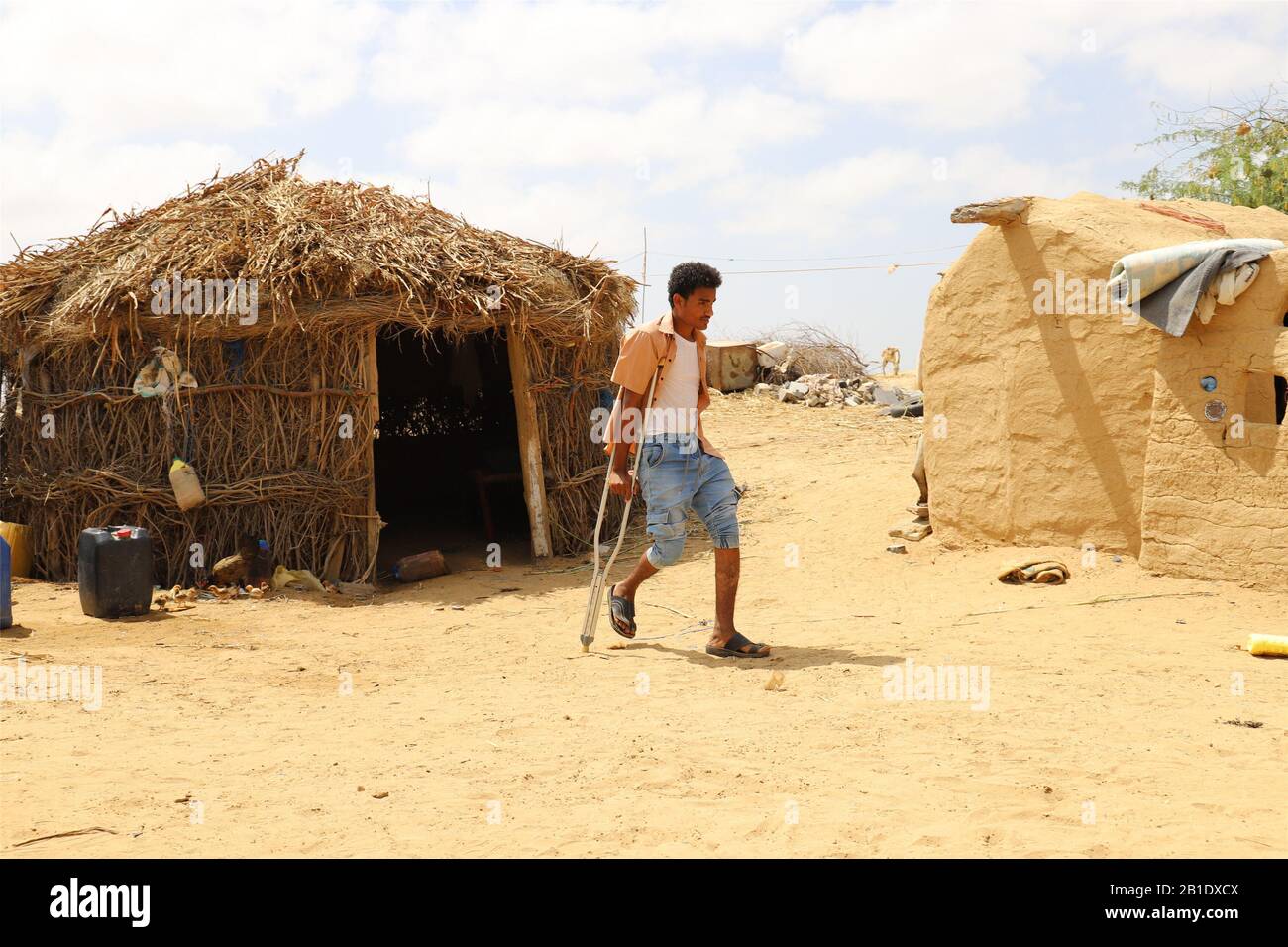 Landmine victim hi-res stock photography and images - Alamy