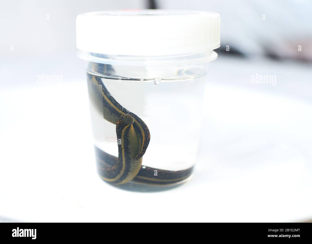 Hirudotherapy procedure, hirudotherapy, leeches as therapy, prevention ...