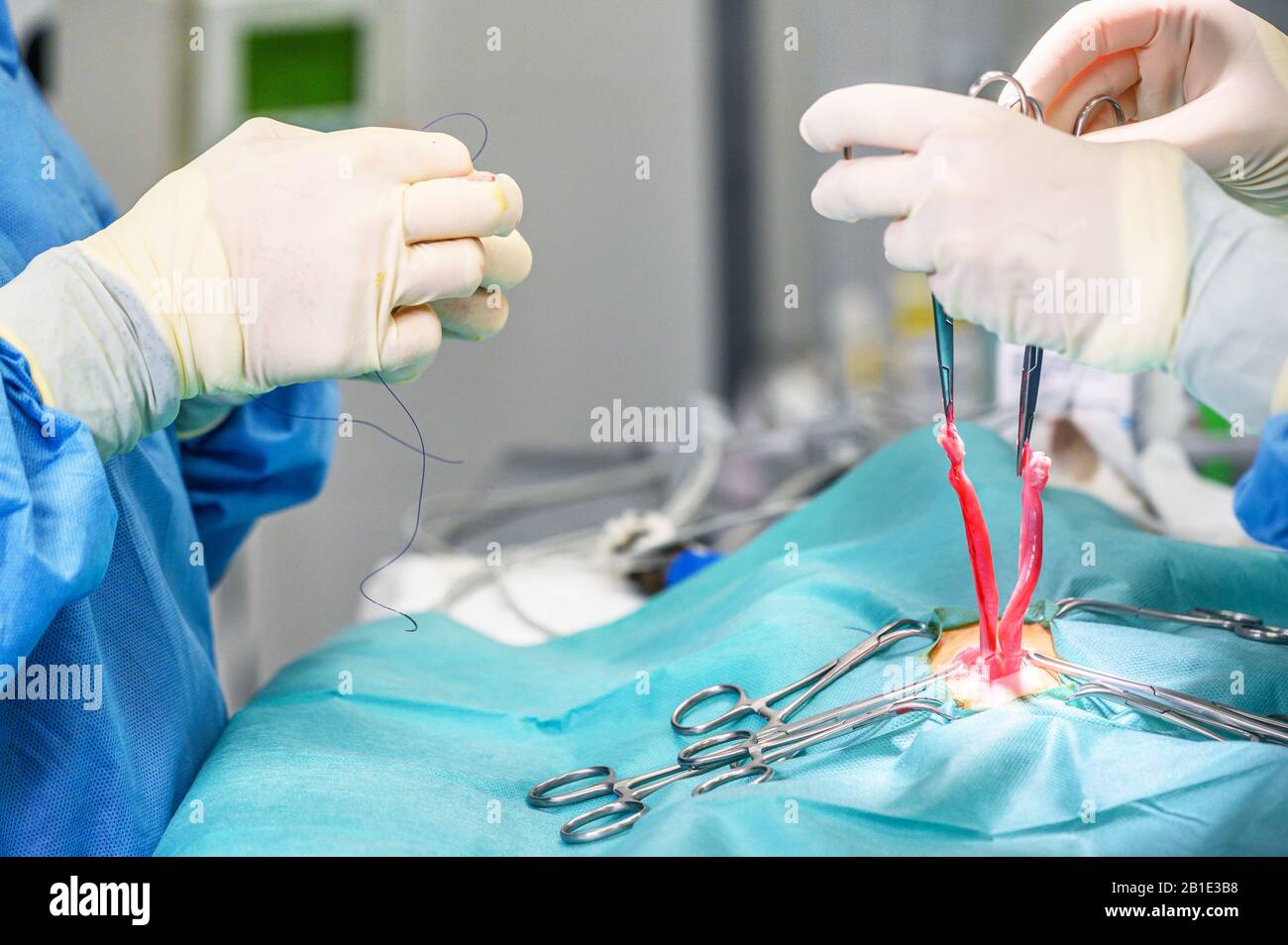 Close-up, Hands of the Professional Surgeon, doing surgery. In the ...