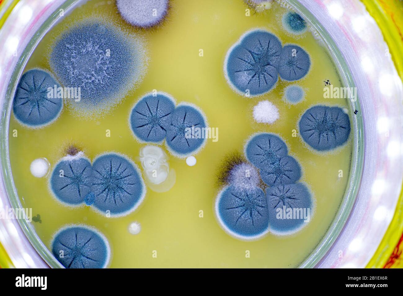 Staphylococcus epidermidis bacteria hi-res stock photography and images ...