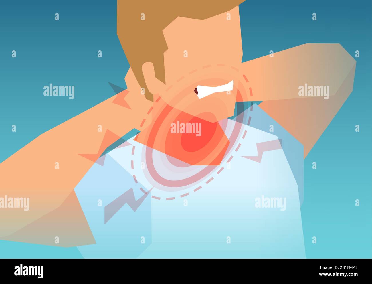 Neck muscle sprain Stock Vector Images - Alamy
