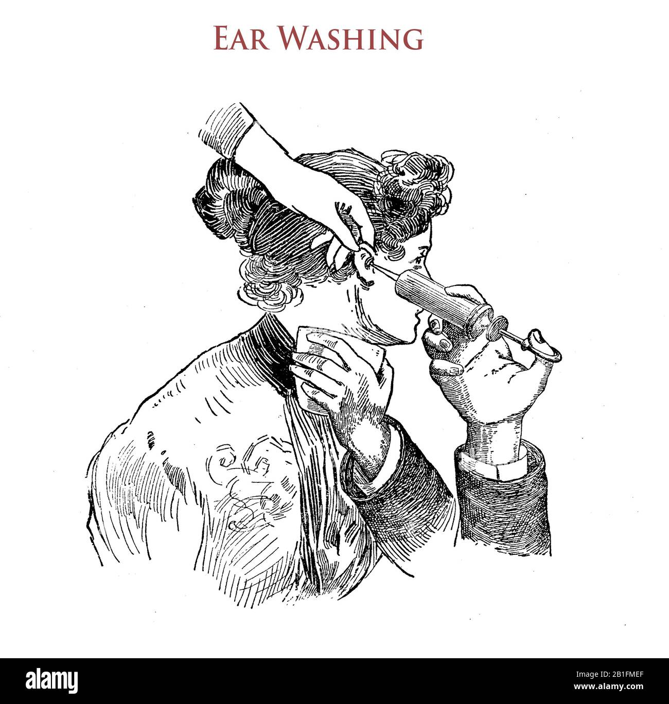 Human earwax (cerumen) Cut Out Stock Images & Pictures - Alamy