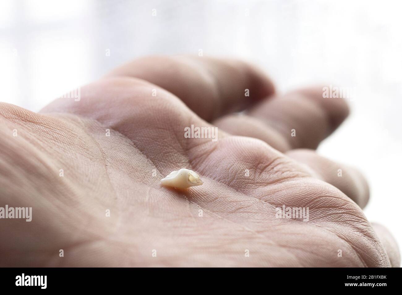 Baby teeth teeth hi-res stock photography and images - Alamy