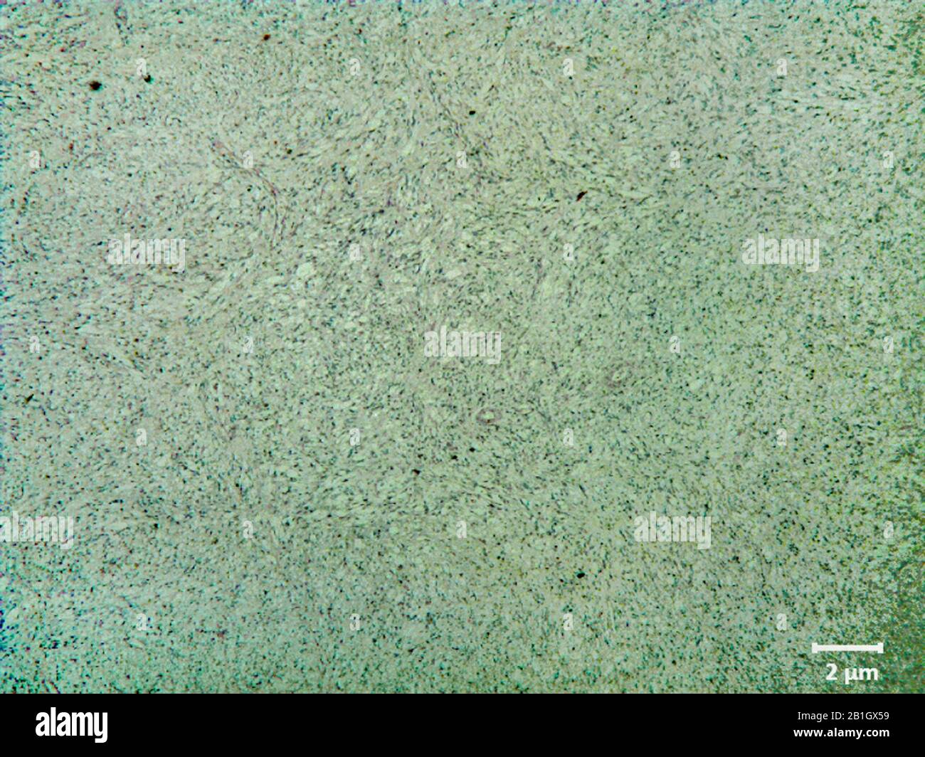 Human testicle hi-res stock photography and images - Alamy