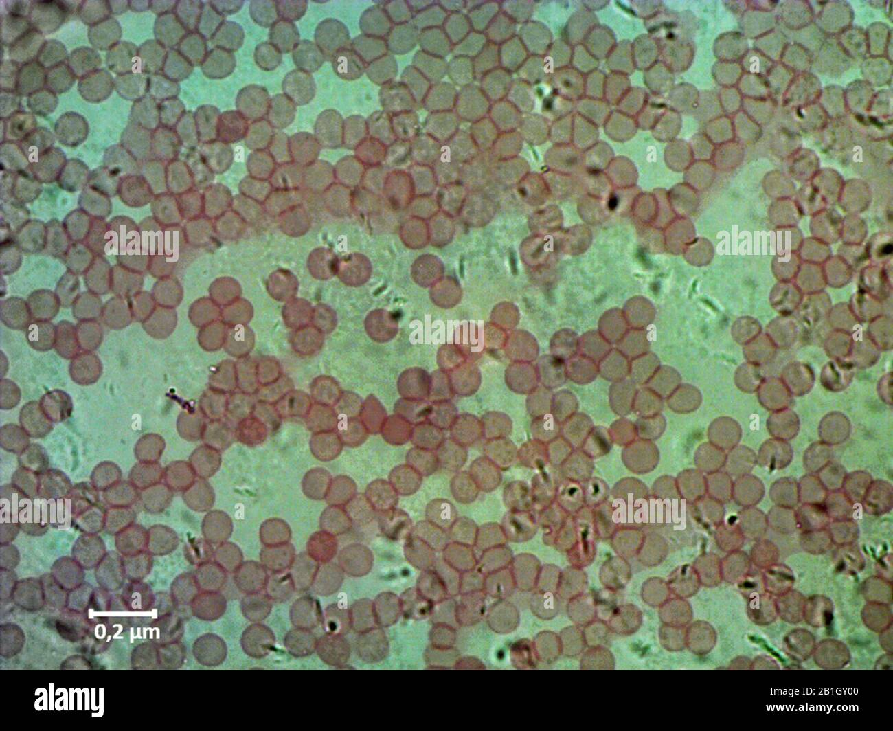 Blood smear microscope hi-res stock photography and images - Alamy