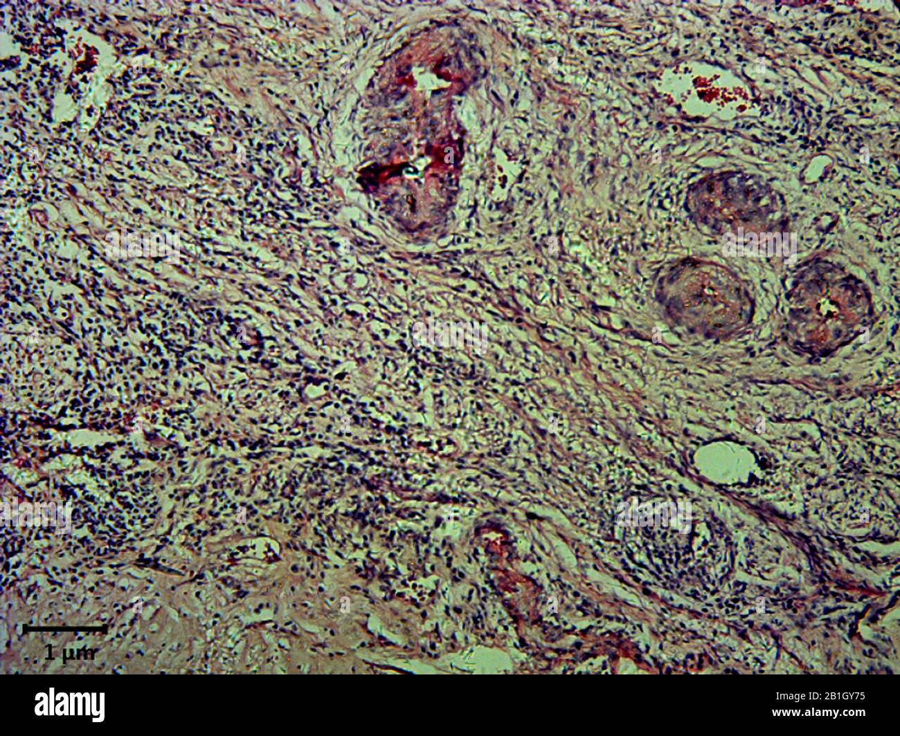 Cervix hi-res stock photography and images - Alamy