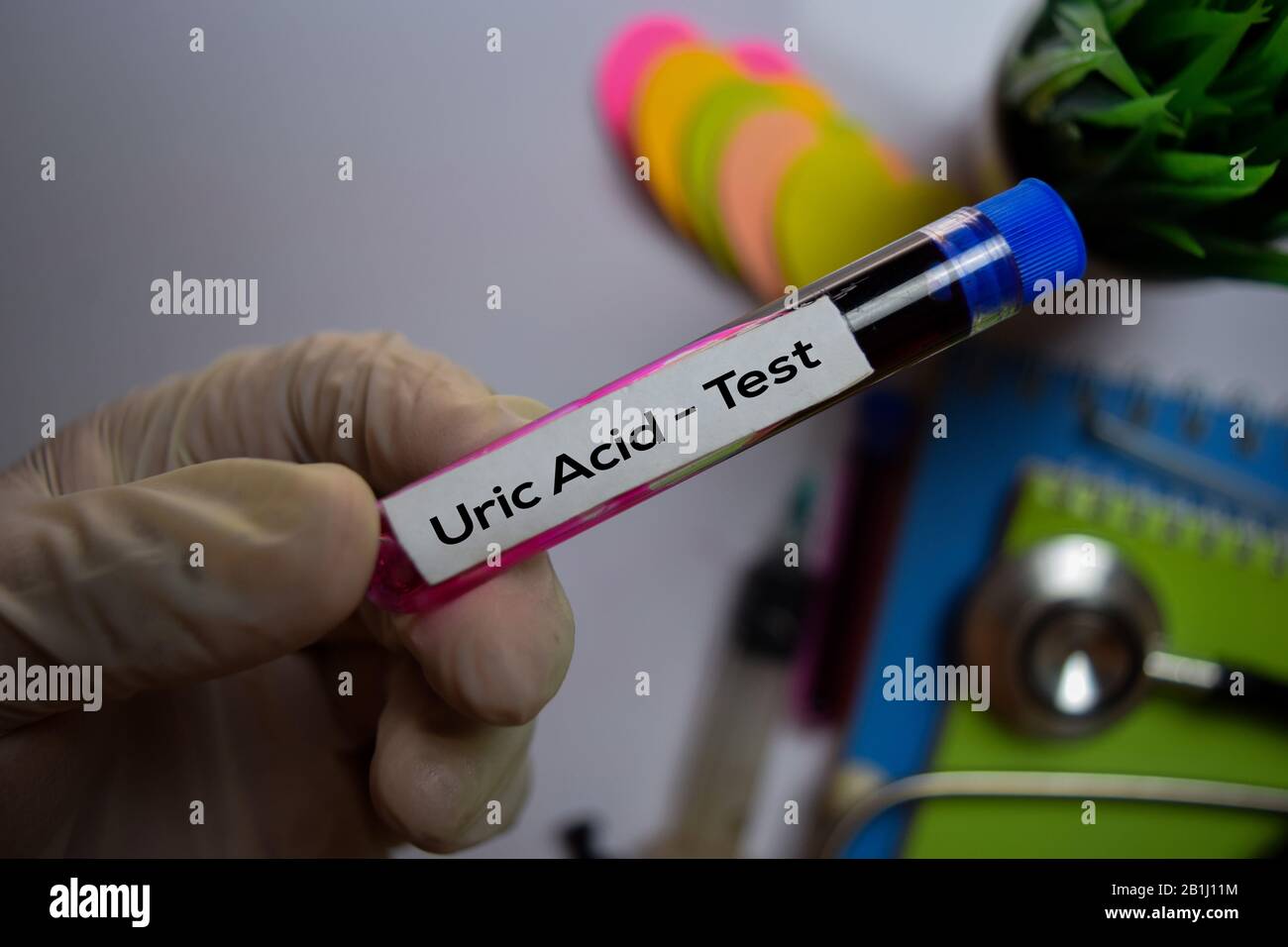 Uric Acid - Test with blood sample. Top view isolated on office desk ...