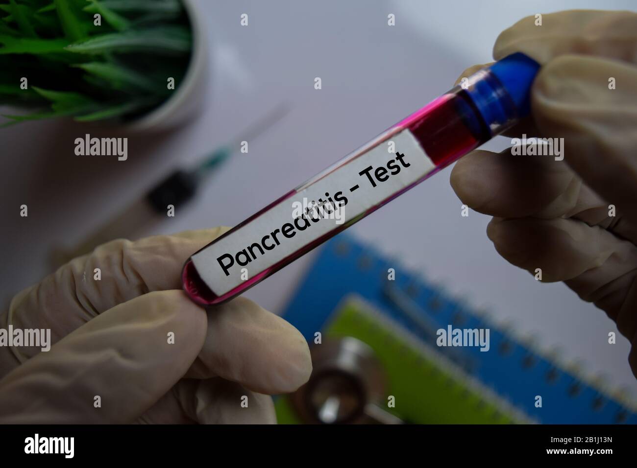 Pancreatitis High Resolution Stock Photography and Images - Alamy