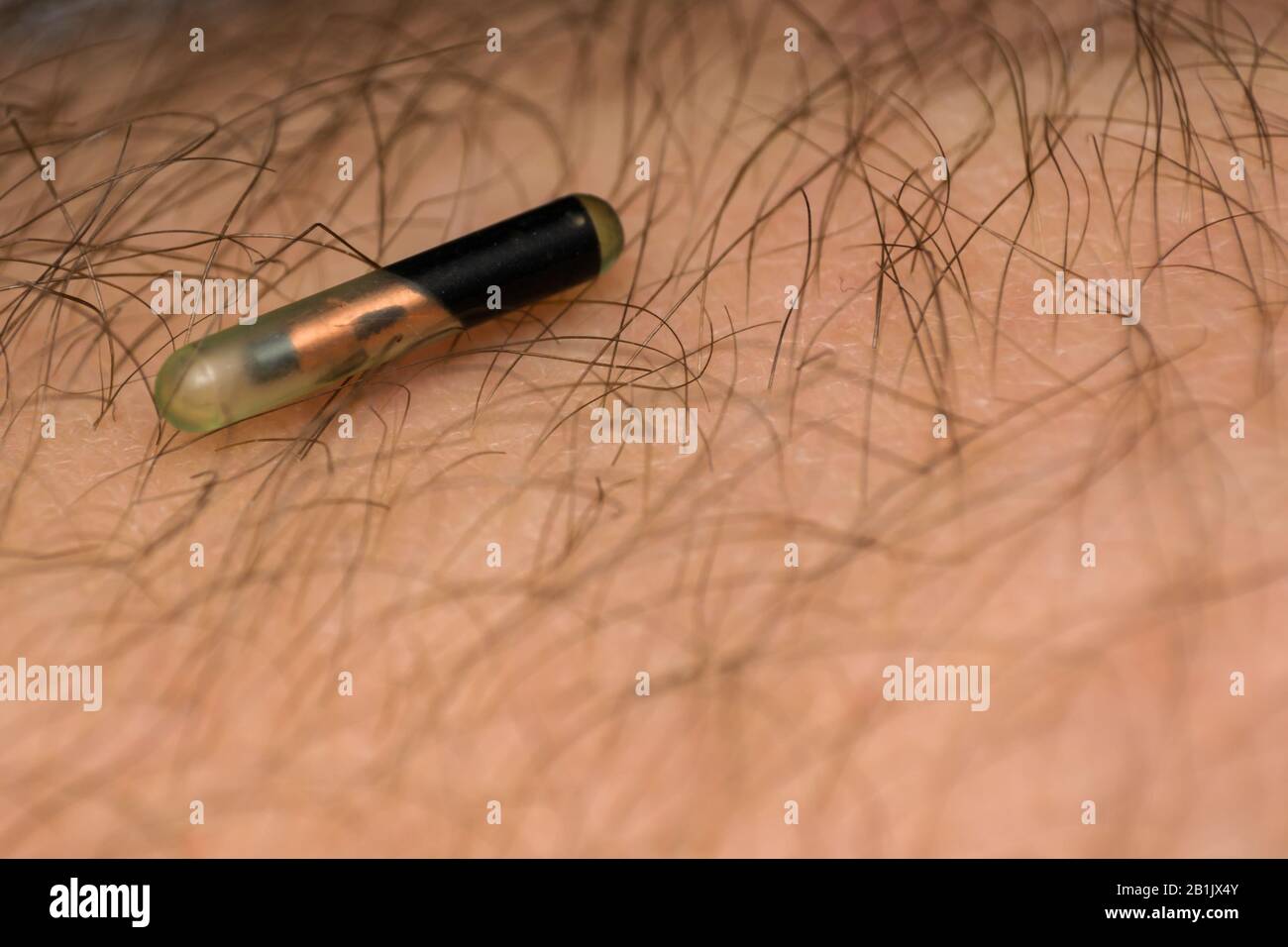 Microchip implant human hi-res stock photography and images - Alamy