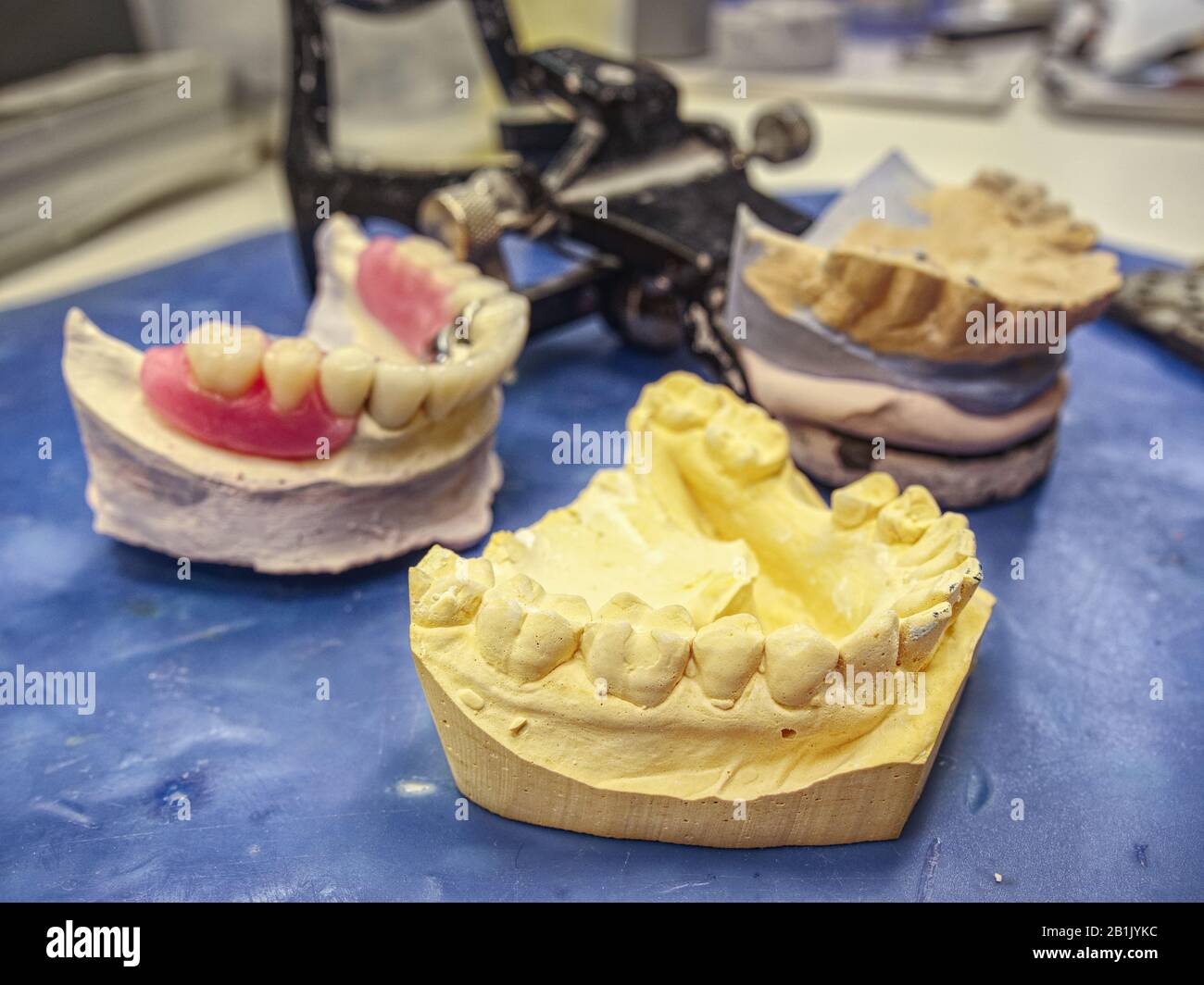 Ceramic dental implants on gypsum layout. Plaster cast stomatologic ...