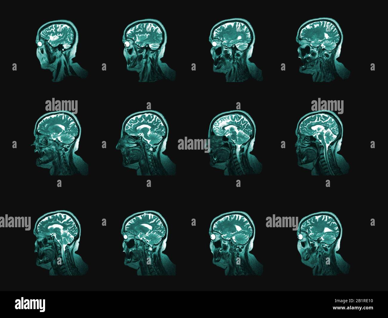 Human head and brain computer tomography image set. Vertical partition ...