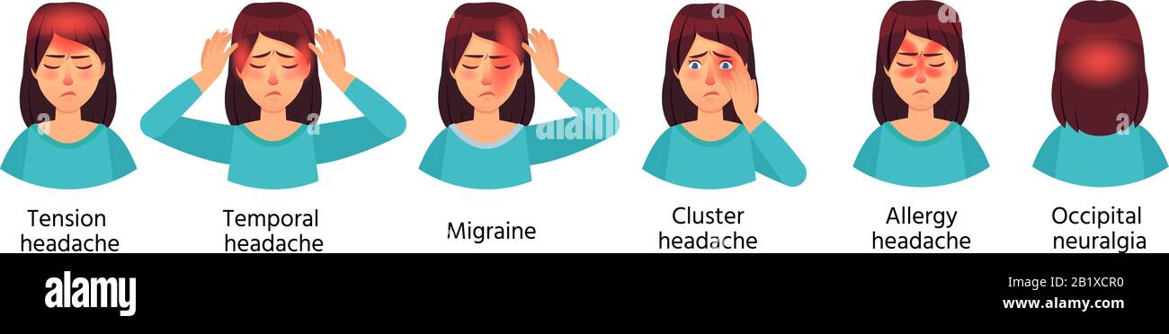 Cartoon headache types. Tension, temporal pain, cluster, allergy and ...
